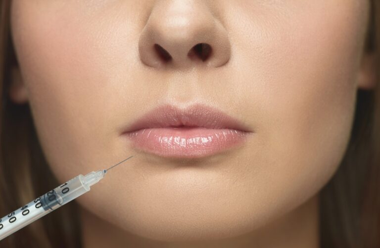 9 Things to Know Before Getting Lip Injections – Expert Advice